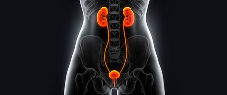 Common Urinary Problems in Women |Urology Expert in Nagpur Common Urinary Problems in Women |Urology Expert in Nagpur